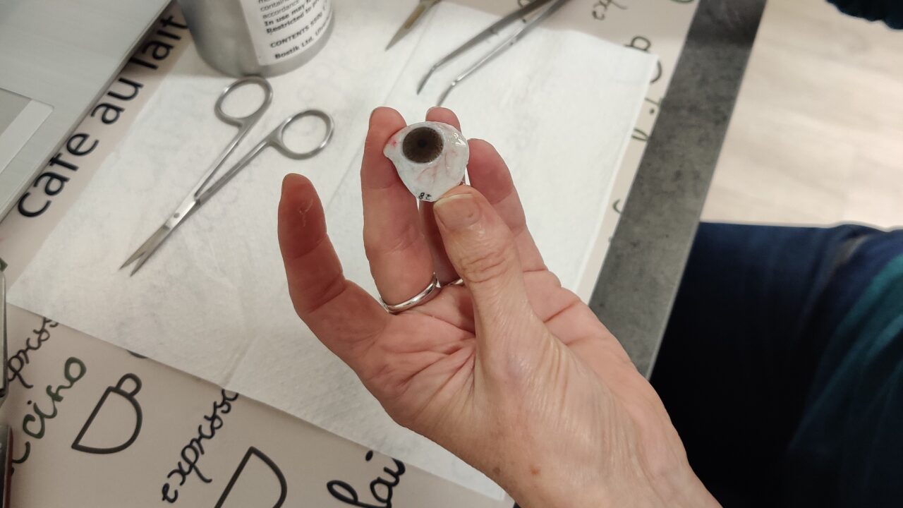 Instructions & care for artificial eye | Gilna Opticians